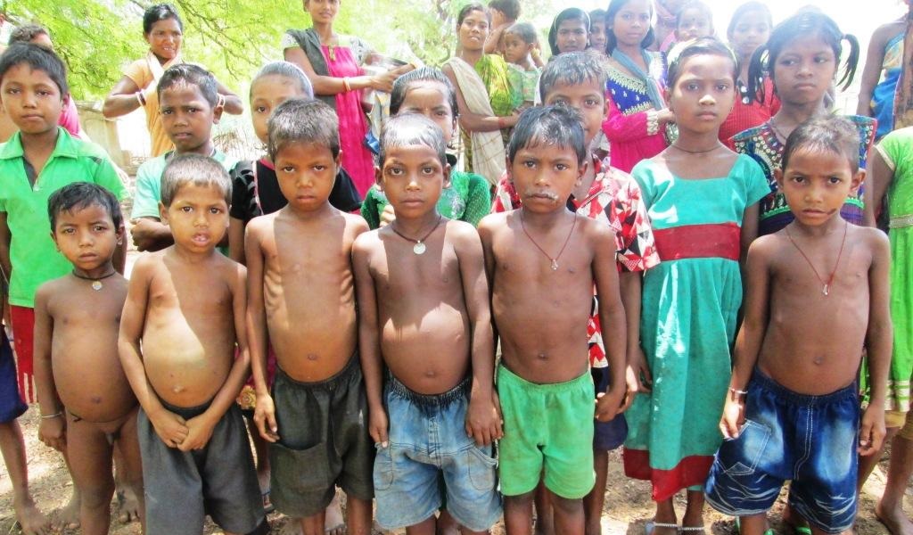 कुपोषण (Malnutrition) – मराठी विश्वकोश