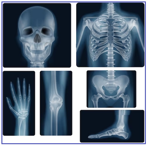 क्ष-किरण : निदान व उपचार (X-ray : Diagnosis and therapy) – मराठी विश्वकोश