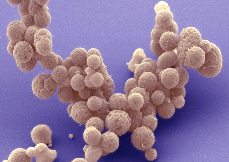 मायकोप्लाझ्मा लॅबोरेटोरियम (Mycoplasma laboratorium) – मराठी विश्वकोश